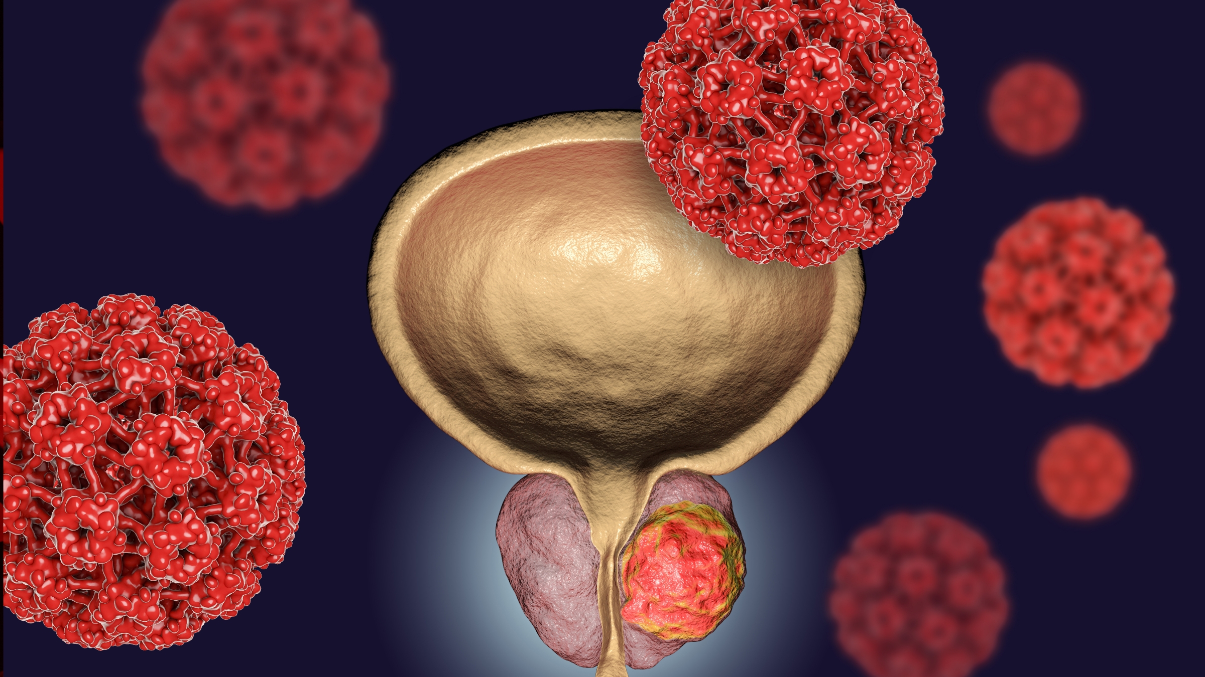 An Artificial Intelligence Platform Supports Prostate Cancer Patients ...