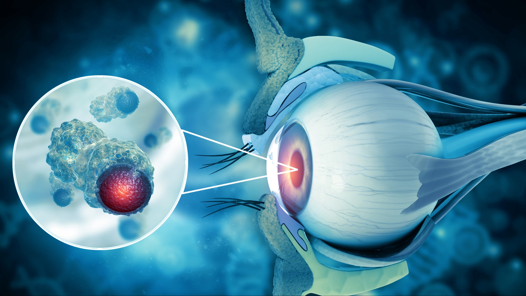 Soft sensor prosthetics - Inside Telecom